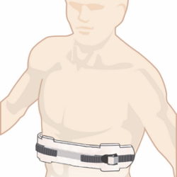 Rib Flaring - Pectus Brace