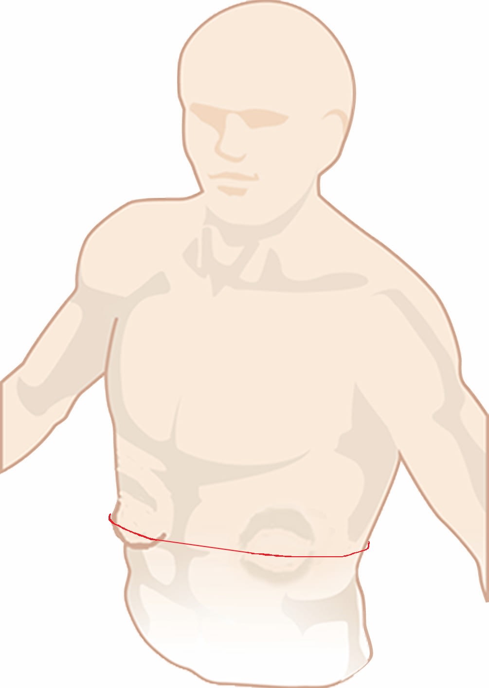 How To Order-RF - Pectus Brace